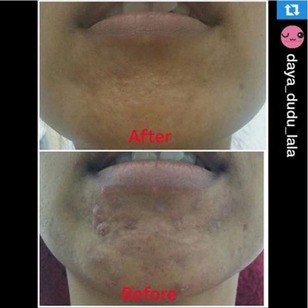 testimonial-lovera-12 | Lovera Malaysia